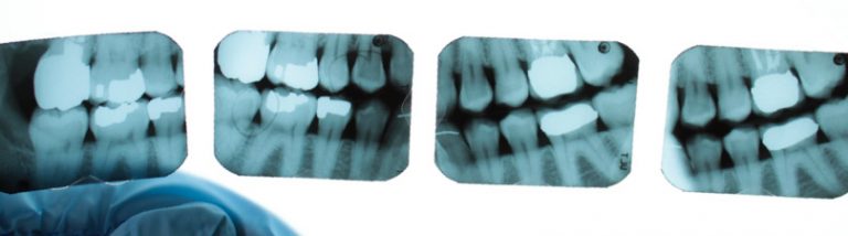 X-Rays - Cape Dental Care